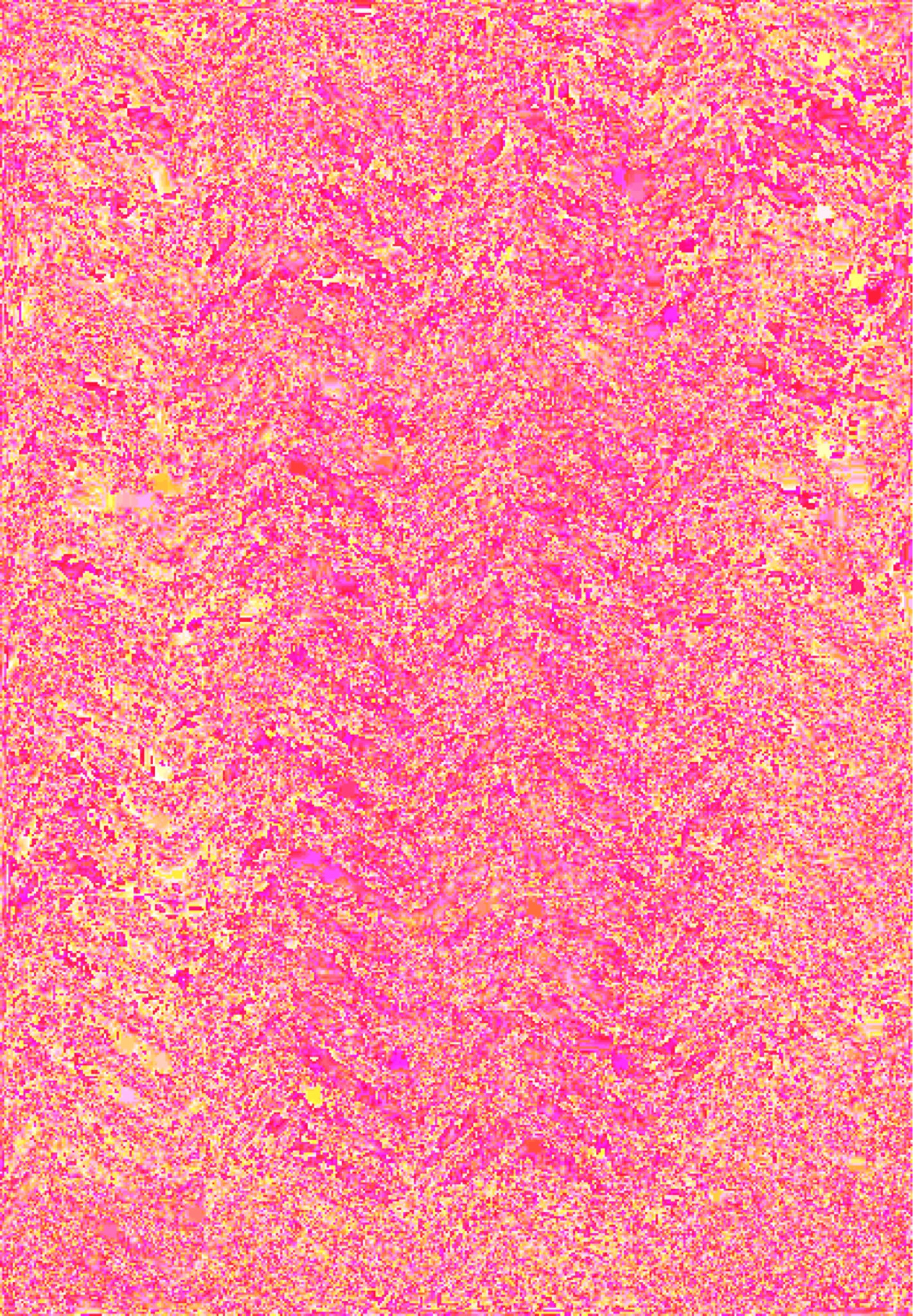 Hot Pink Glitter Chevron Background